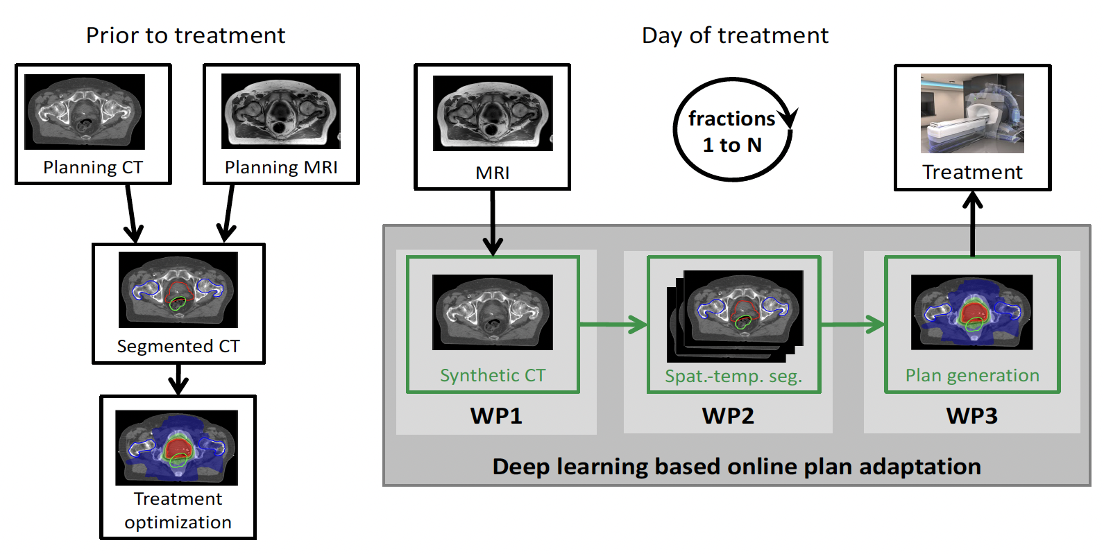 Development of a Deep Learning Toolkit for MRI-Guided Online Adaptive Radiotherapy | Albarqouni Lab
