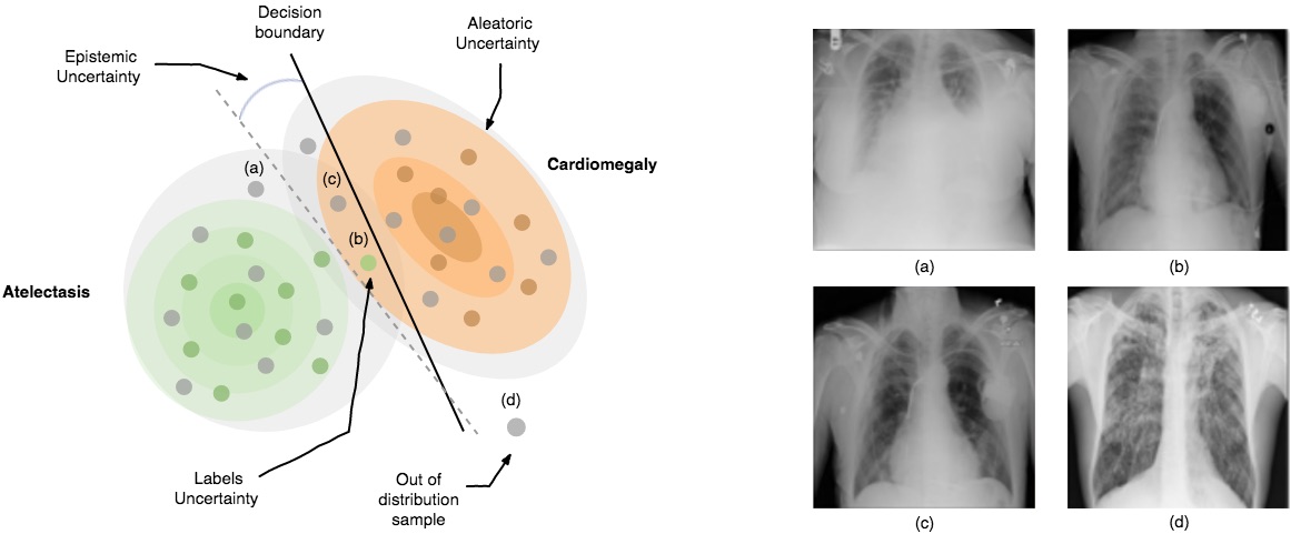 Modelling Uncertainty in Deep Learning for Medical Applications ...