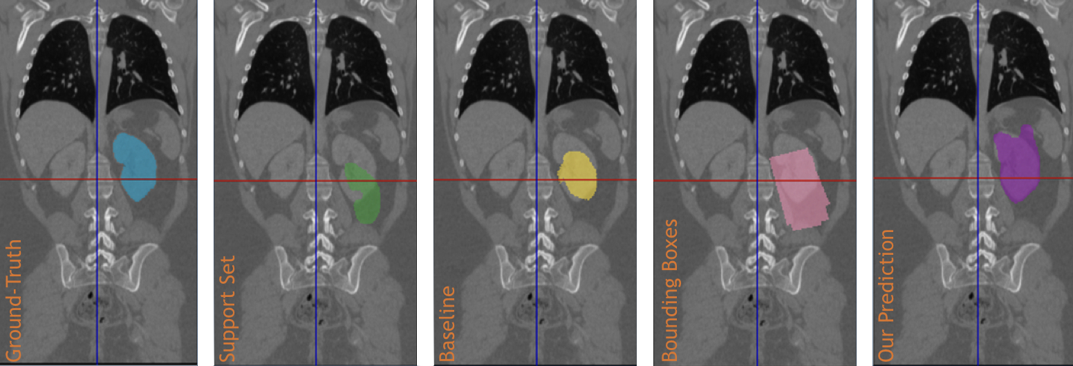 Learn to Segment Organs with a Few Bounding Boxes | Albarqouni Lab